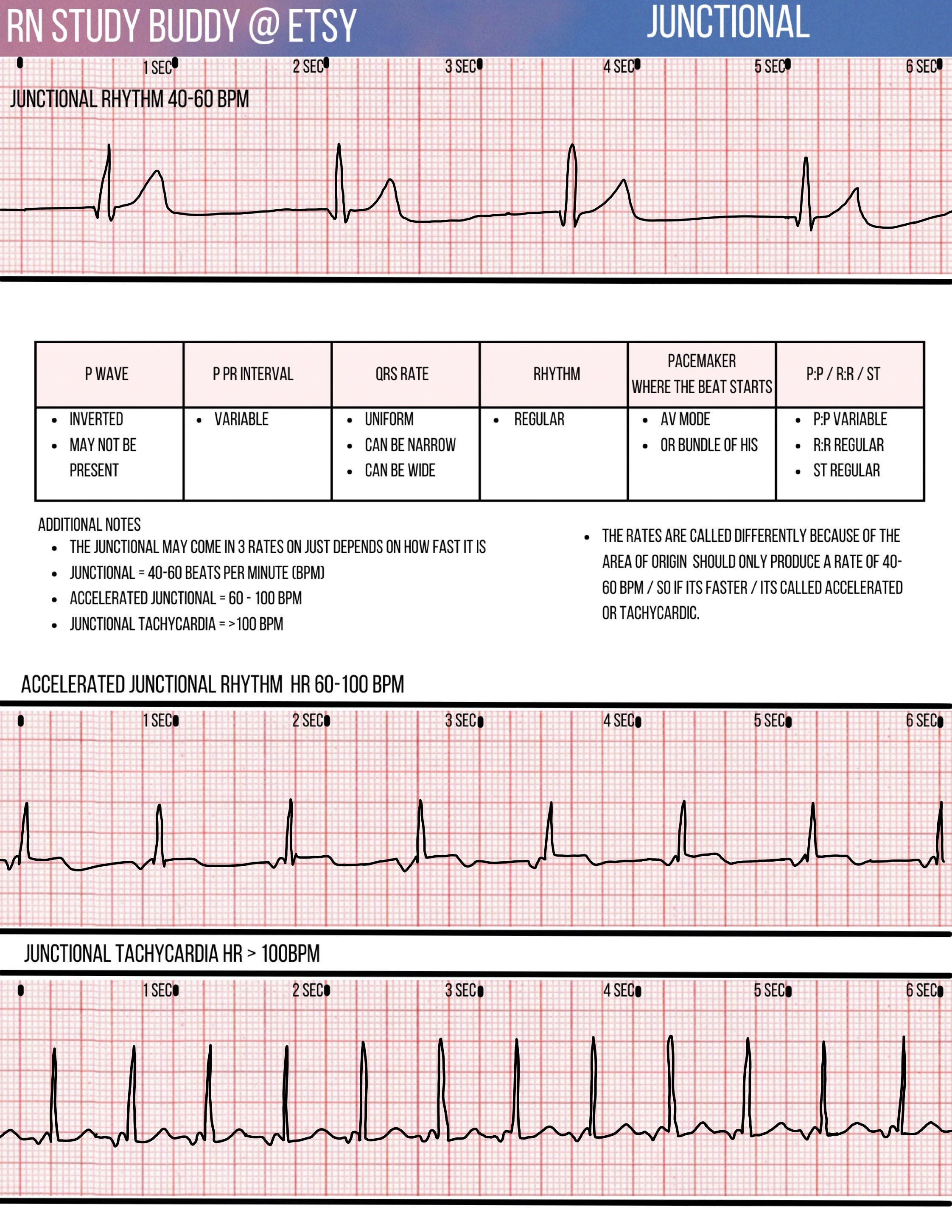 38 Pages Easy EKG and Master the Basics Like Heart Blocks, Help With ...