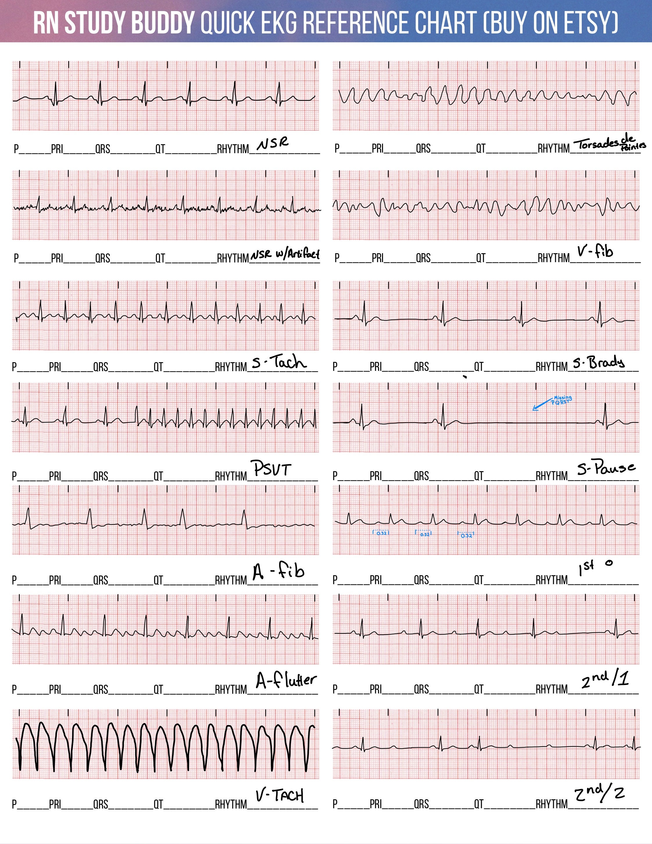 38 Pages Easy EKG and Master the Basics Like Heart Blocks, Help With ...