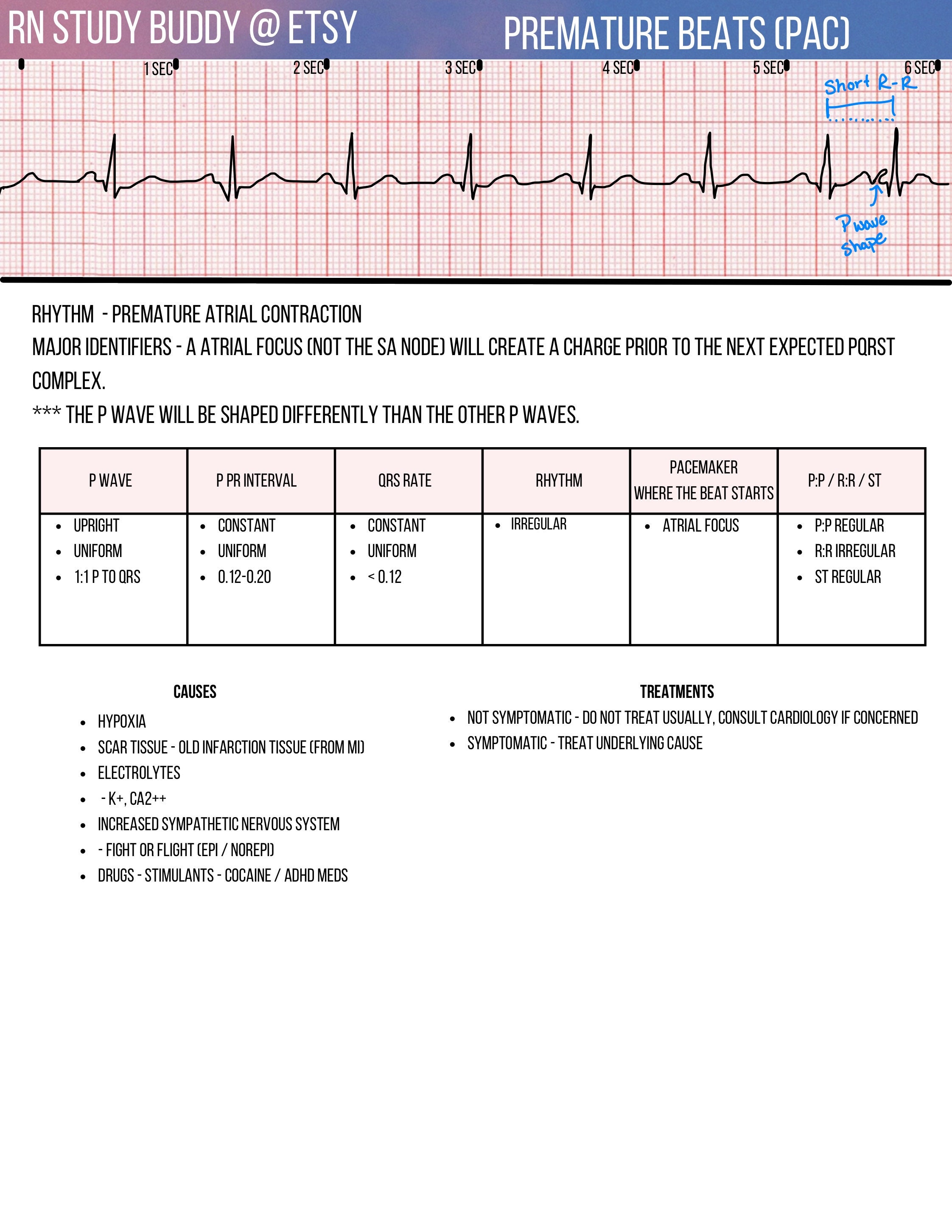 38 Pages Easy EKG and Master the Basics Like Heart Blocks, Help With Junctional Rhythms ...