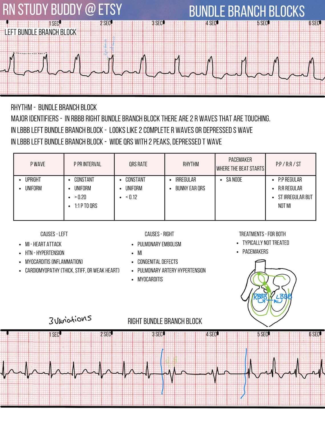 38 Pages Easy EKG and Master the Basics Like Heart Blocks, Help With ...