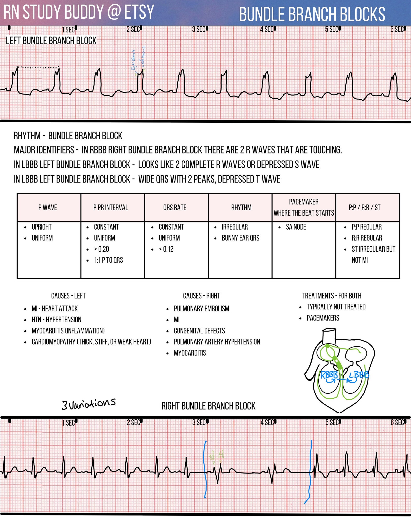 38 Pages Easy EKG and Master the Basics Like Heart Blocks, Help With ...