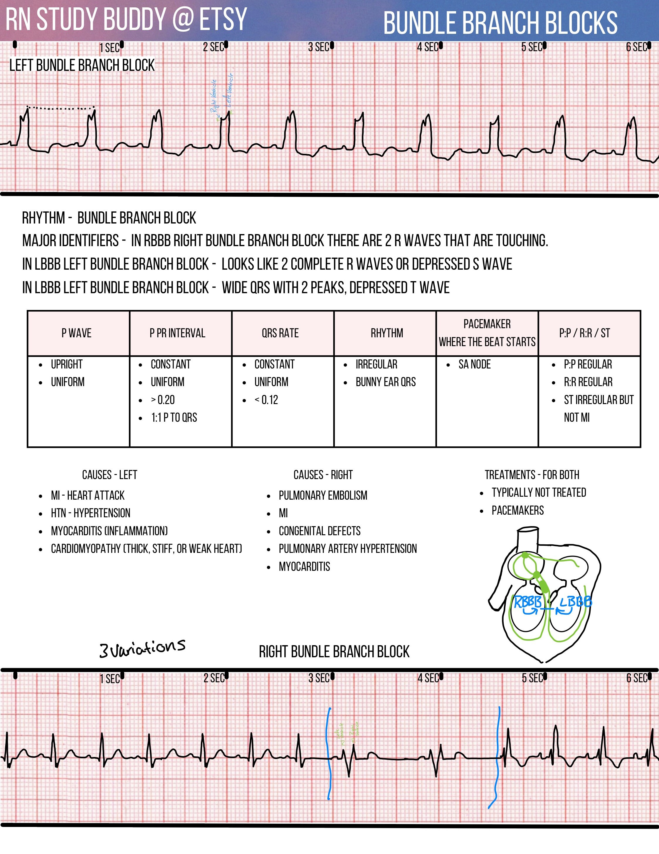 38 Pages Easy EKG and Master the Basics Like Heart Blocks, Help With Junctional Rhythms ...