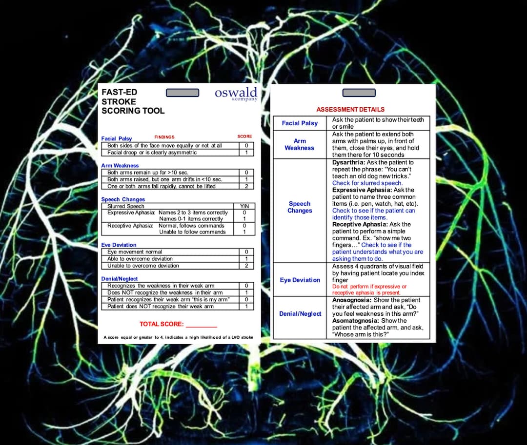 FAST-ED Stroke Badge Buddy, Paramedic, Nurse, Doctor, EMS, Scoring Tool ...
