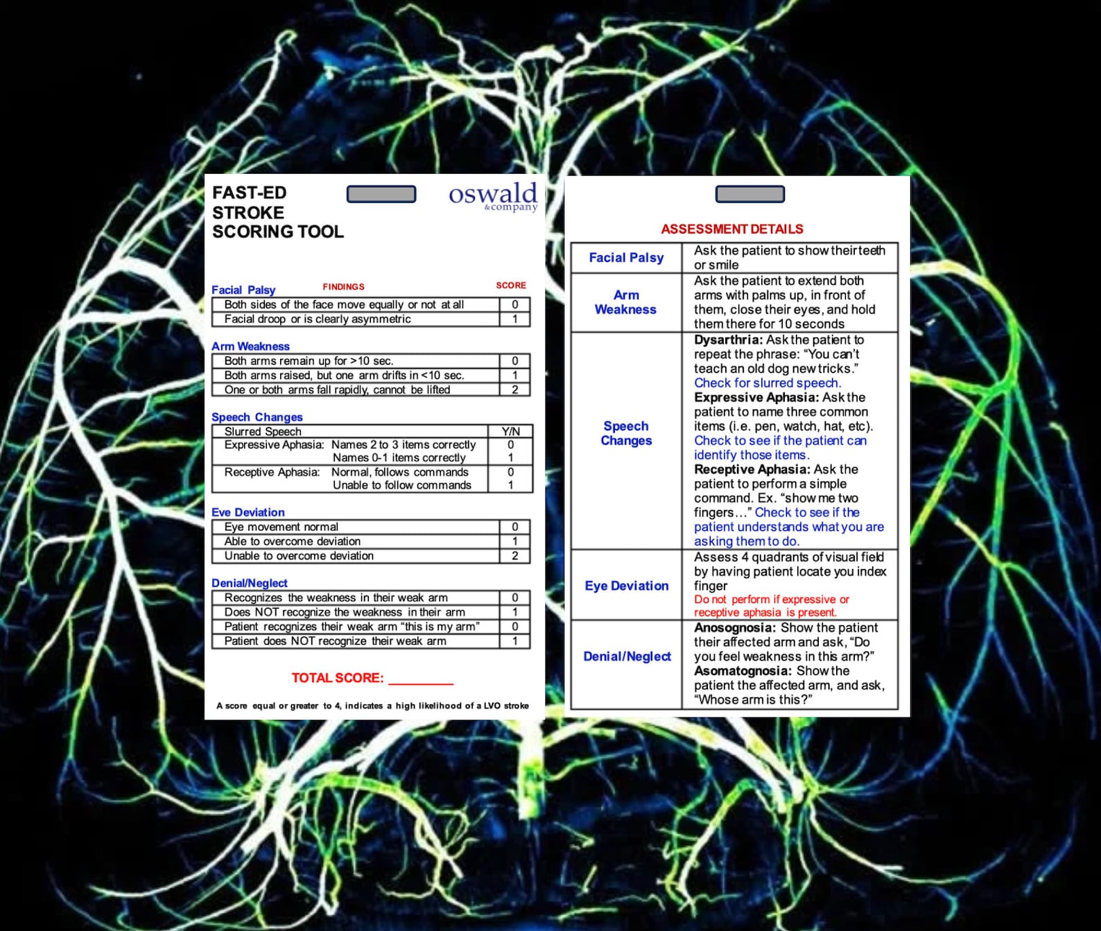 FAST-ED Stroke Badge Buddy, Paramedic, Nurse, Doctor, EMS, Scoring Tool ...