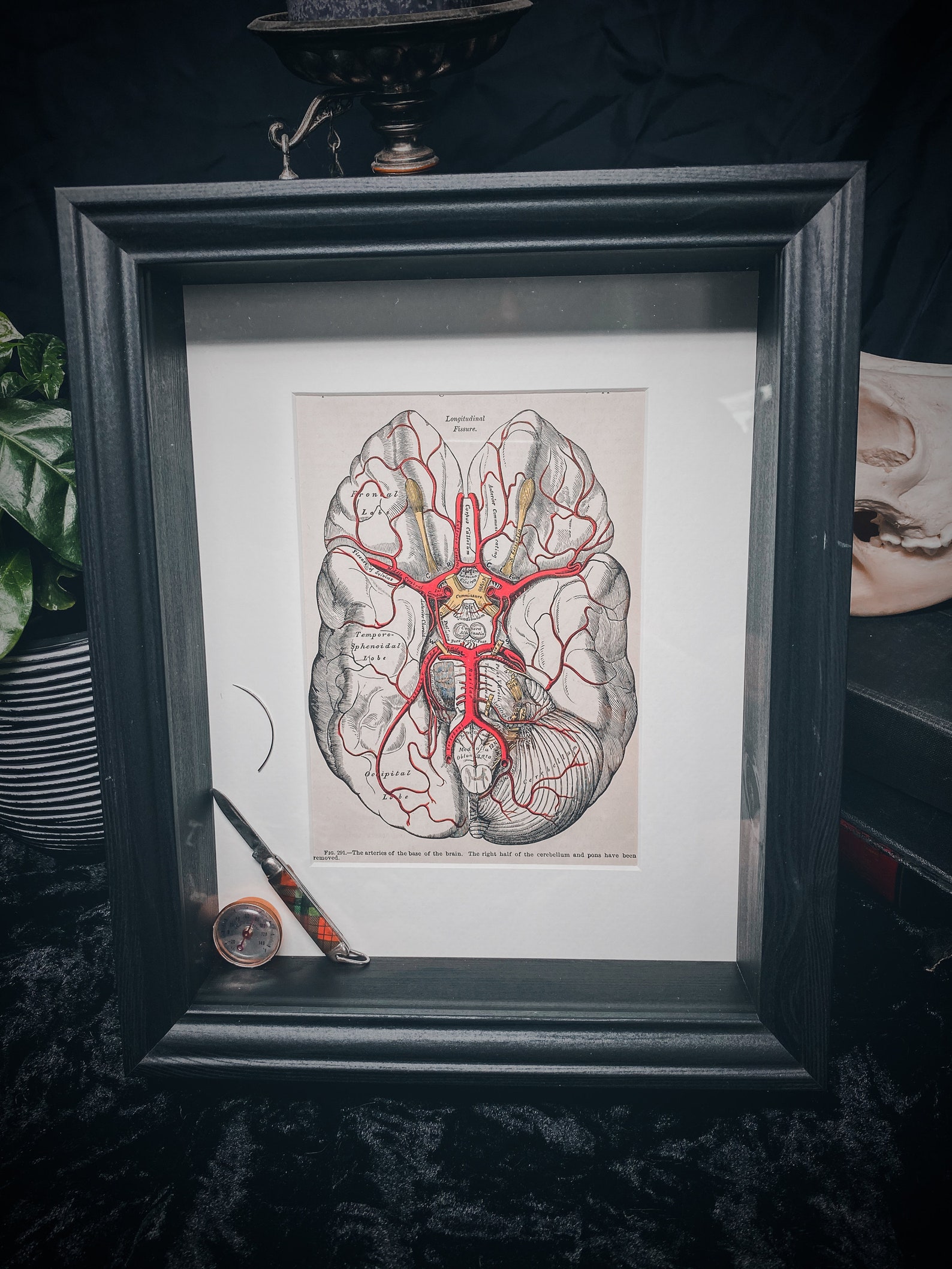 Authentic Surgical Needle & Human Brain Grey's Anatomy - Etsy