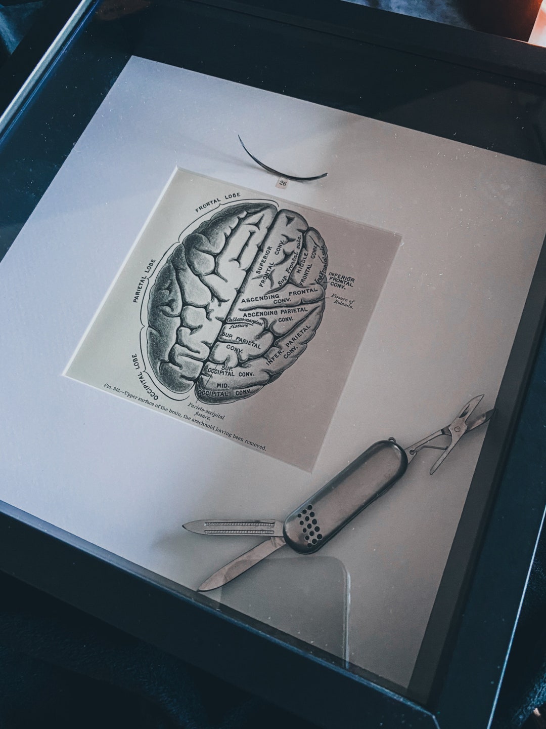 Authentic Surgical Needle & Human Brain Grey's Anatomy Shadow Box ...