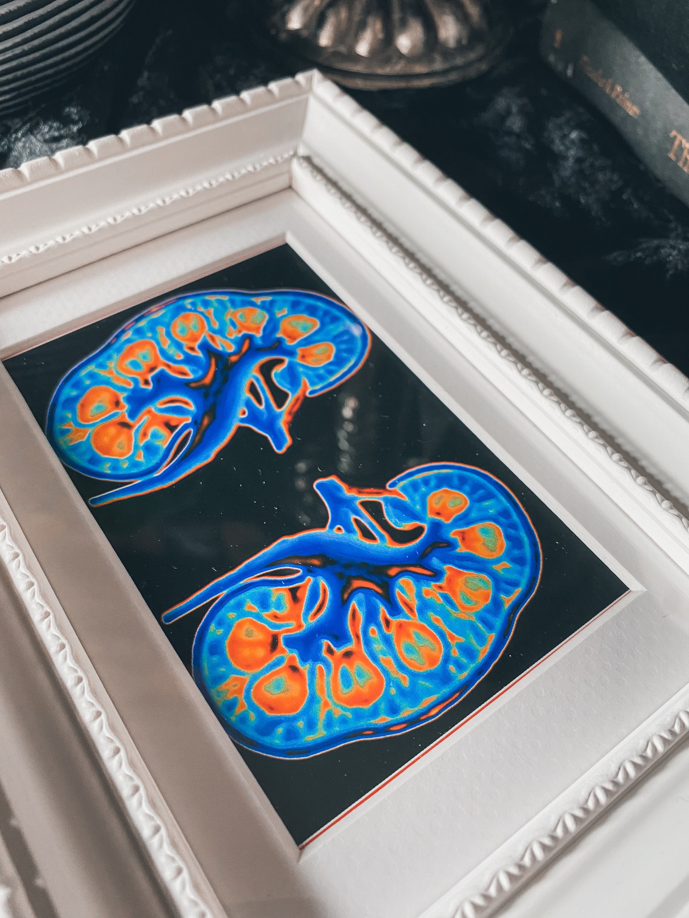 Other Assemblage Art & Collectibles Weird Gothic Kidney MRI Grey's ...