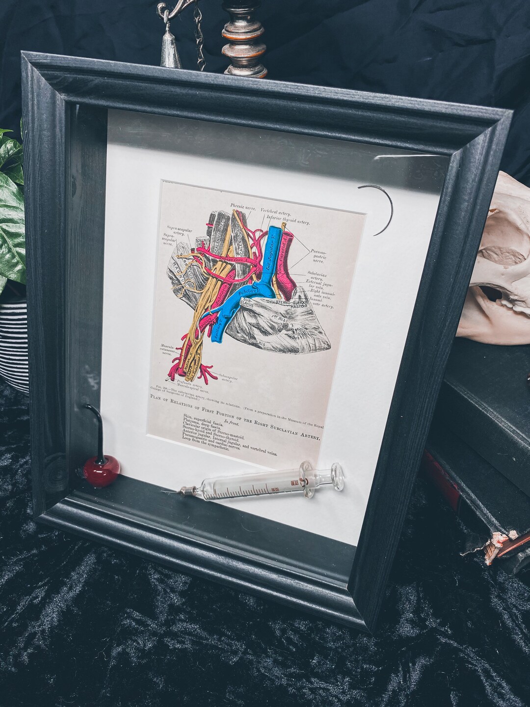 Authentic Surgical Needle & Human Heart Grey's Anatomy Picture Frame ...