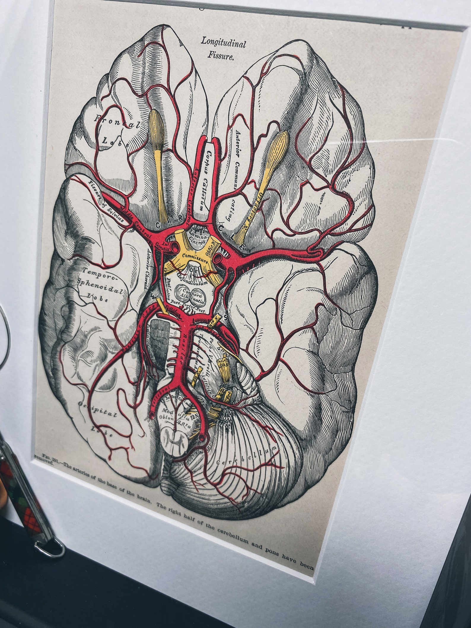 Authentic Surgical Needle & Human Brain Grey's Anatomy - Etsy