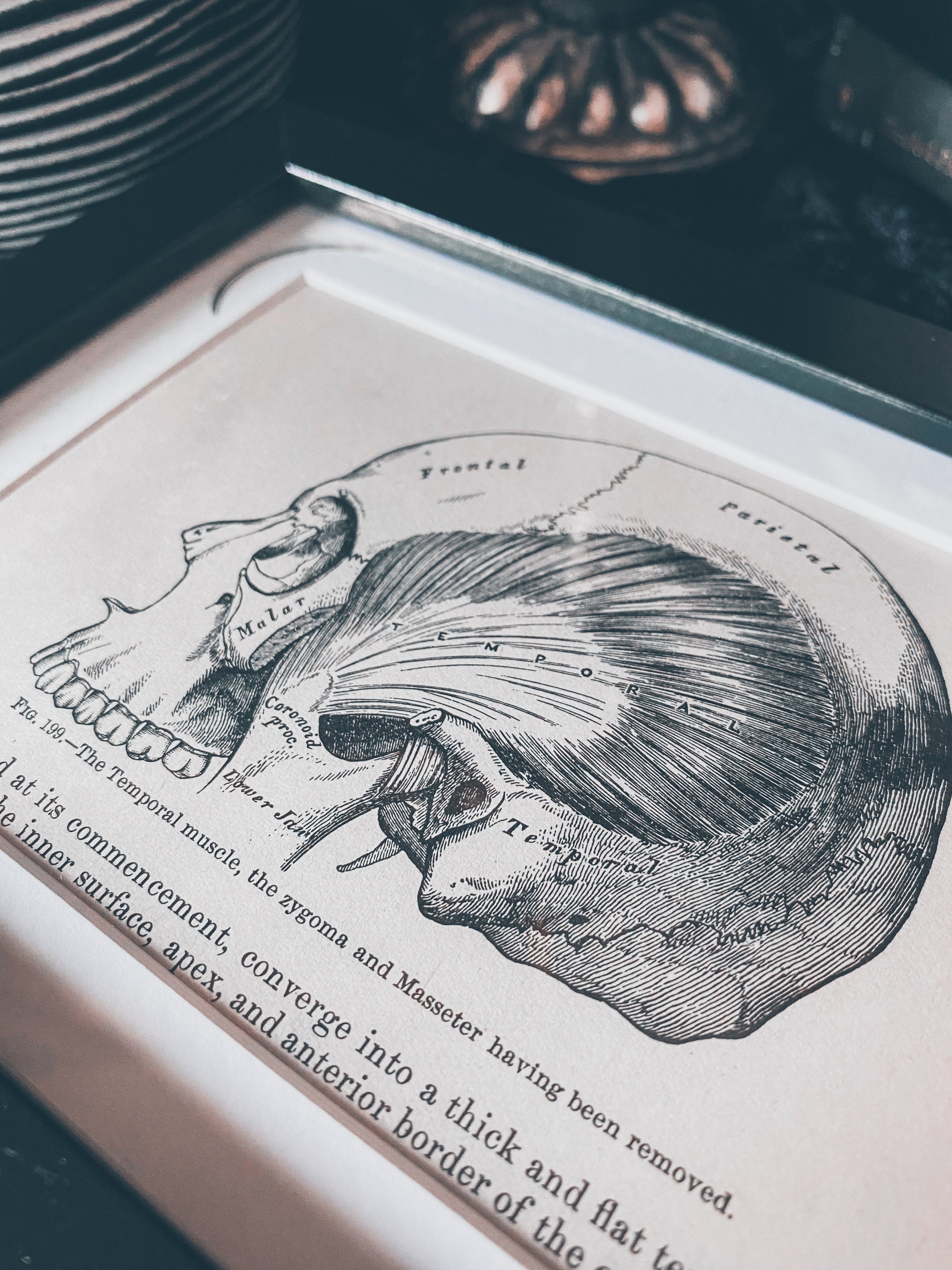 Authentic Surgical Needle & Human Skull Grey's Anatomy - Etsy