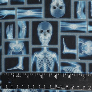 Skeleton X-ray Fabric, Human X-ray Fabric With Full Moons Fabric ...