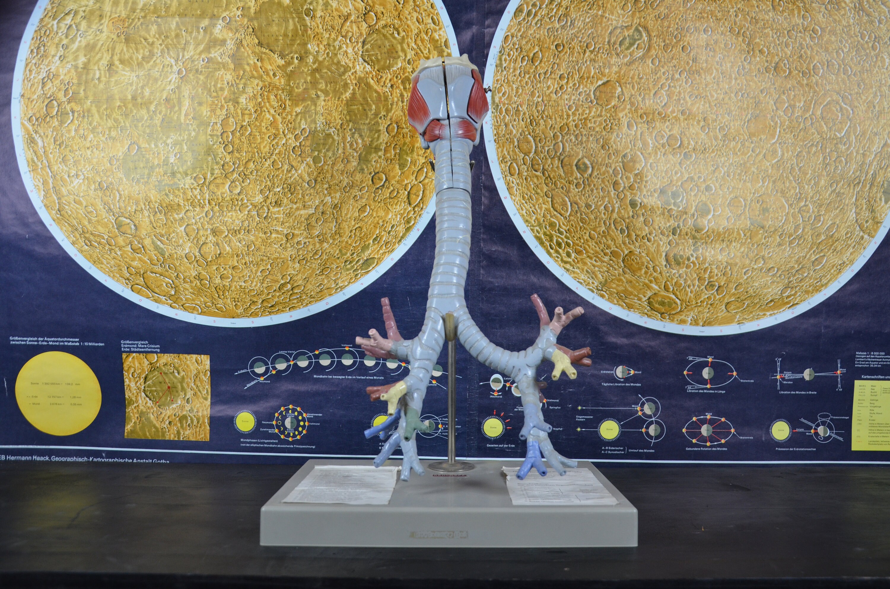 Larynx & Trachea Bronchail Tree: Large Vintage 1970s - Etsy