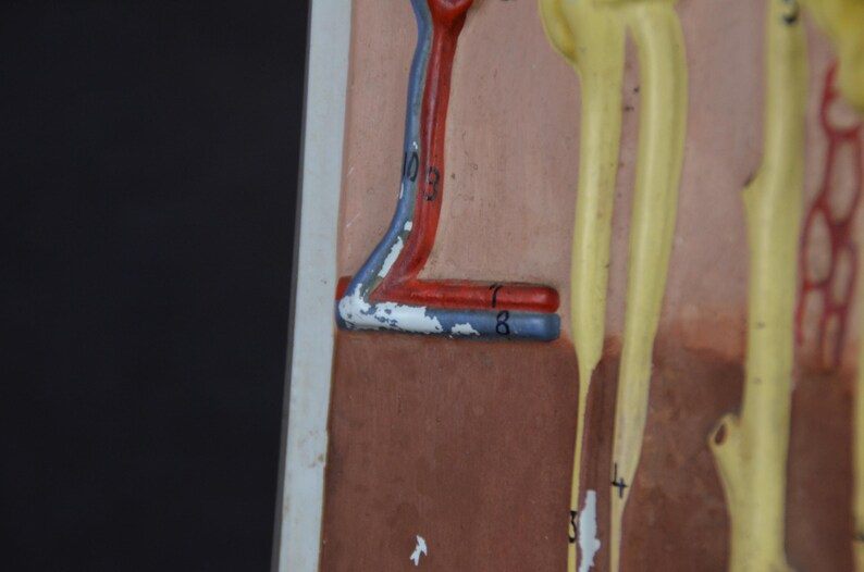 Human Nephron, Kidney Anatomy, Vintage Anatomy Model: RARE Original ...