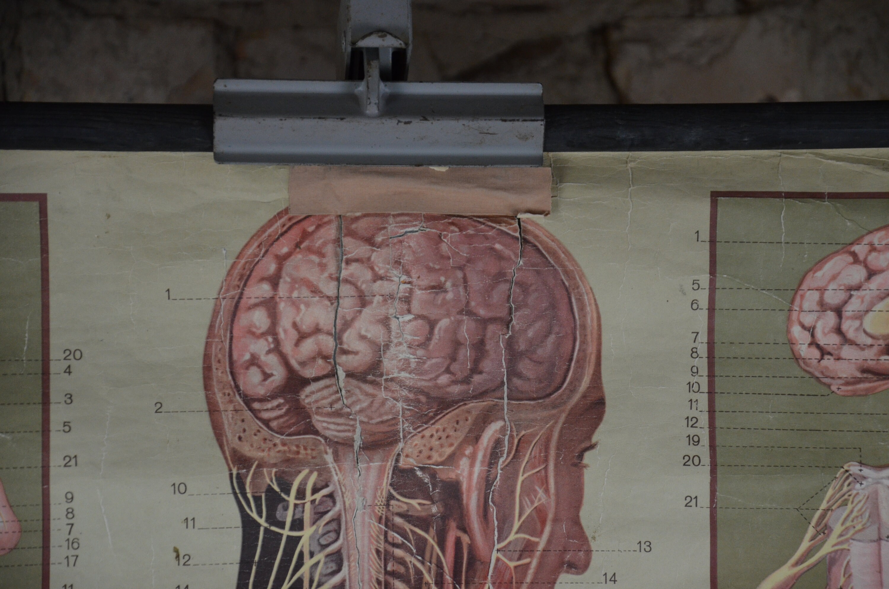 Human Nervous System, Anatomy: Original Antique 1920s German ...