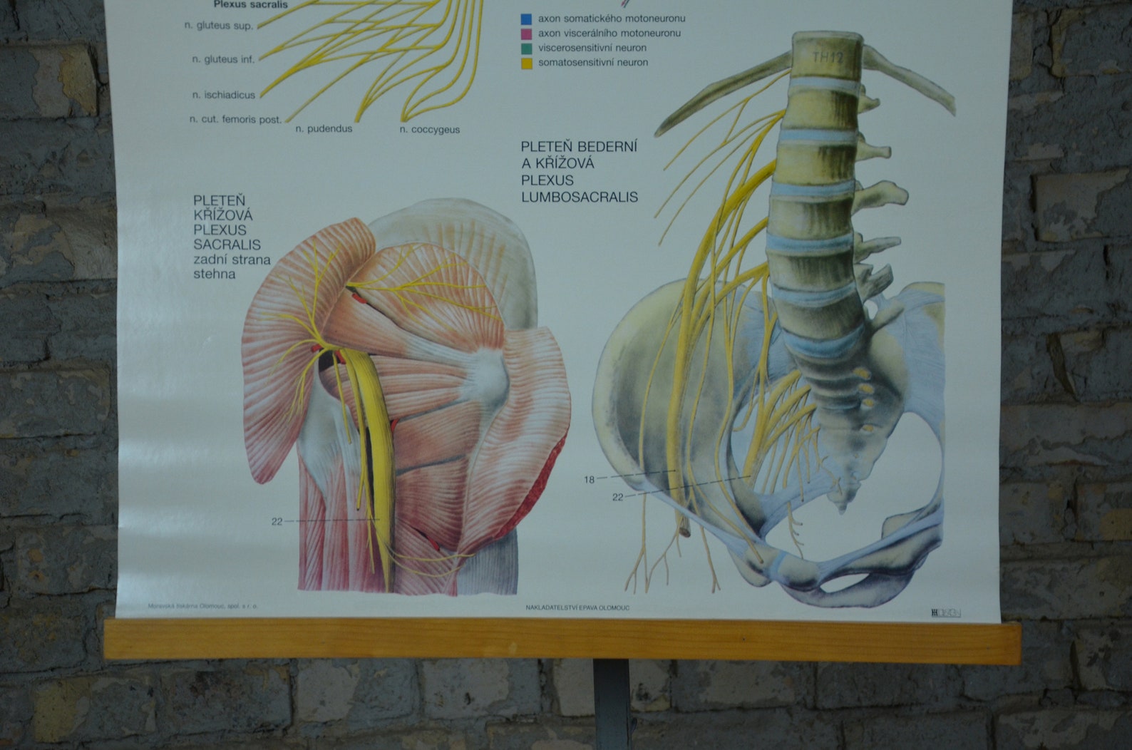 Spinal Nerves, Arm, Neurology: Original Vintage 1990s Czech Educational ...