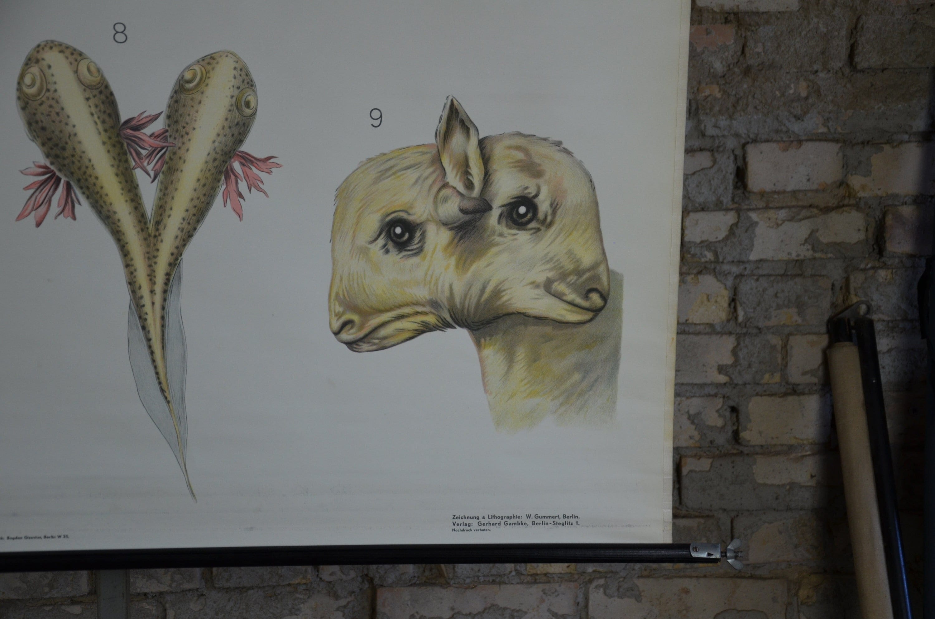 Conjoined Twins Embryology