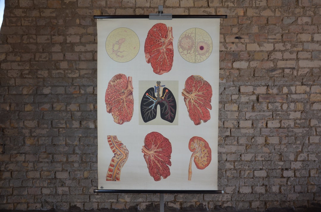 Lung Tuberculosis, Respiratory Organs, Human Anatomy: Original Vintage ...