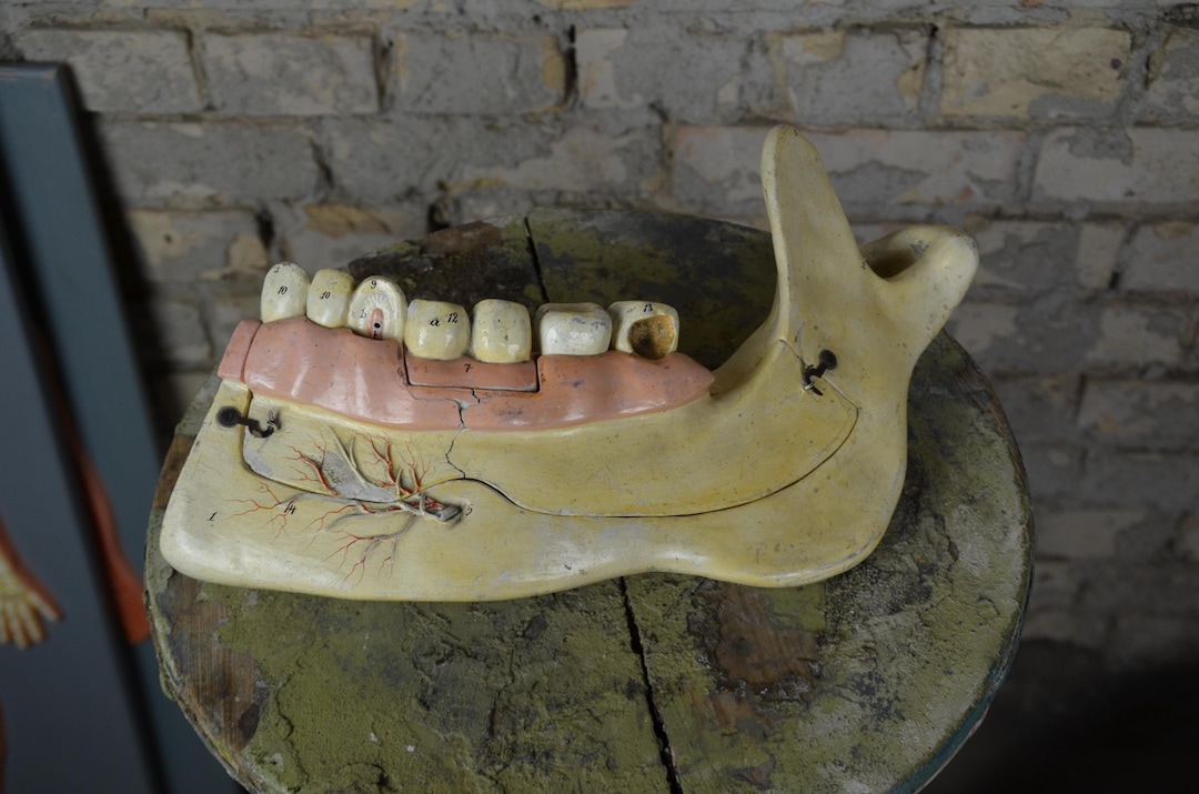 Exceptional Antique EARLY Human Jaw, Teeth Anatomy Model: Original ...