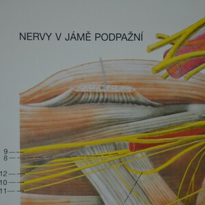 Spinal Nerves, Arm, Neurology: Original Vintage 1990s Czech Educational ...