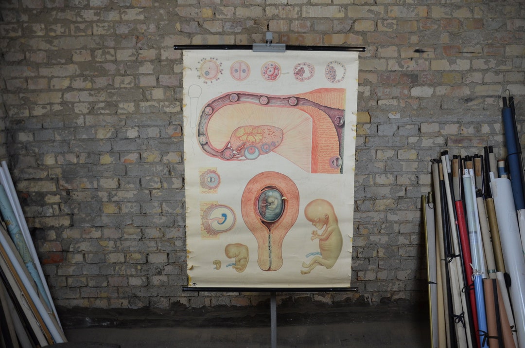 Female Anatomy Uterus Embryo Development: Original Vintage - Etsy
