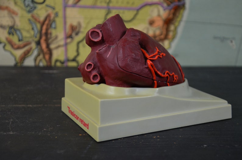 Human Heart Specimen Original Vintage Anatomical Model: - Etsy