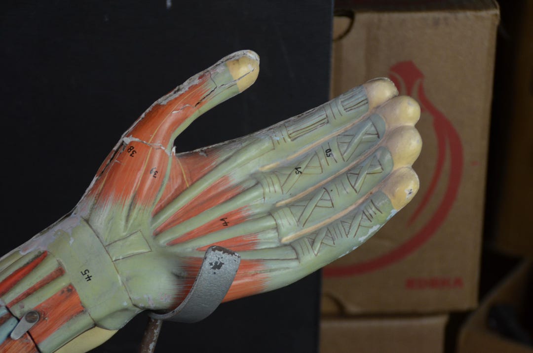 Muscles of the Human Arm & Hand, Exceptional Antique Anatomy Model ...