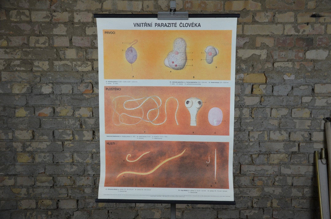 Tapeworm, Parasite: Original Vintage 1980s Czech Educational Poster ...