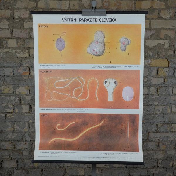 Parasite Chart - Etsy