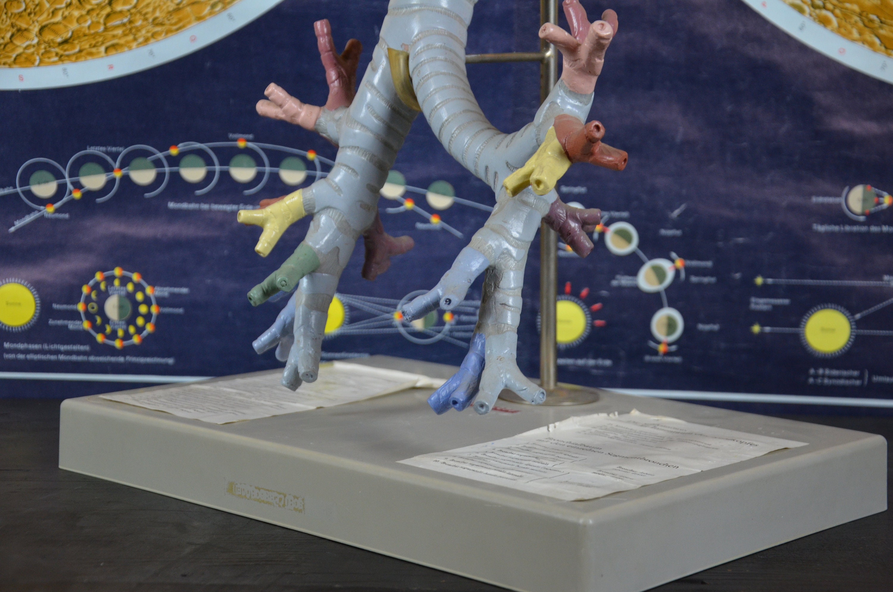 Larynx & Trachea Bronchail Tree: Large Vintage 1970s - Etsy