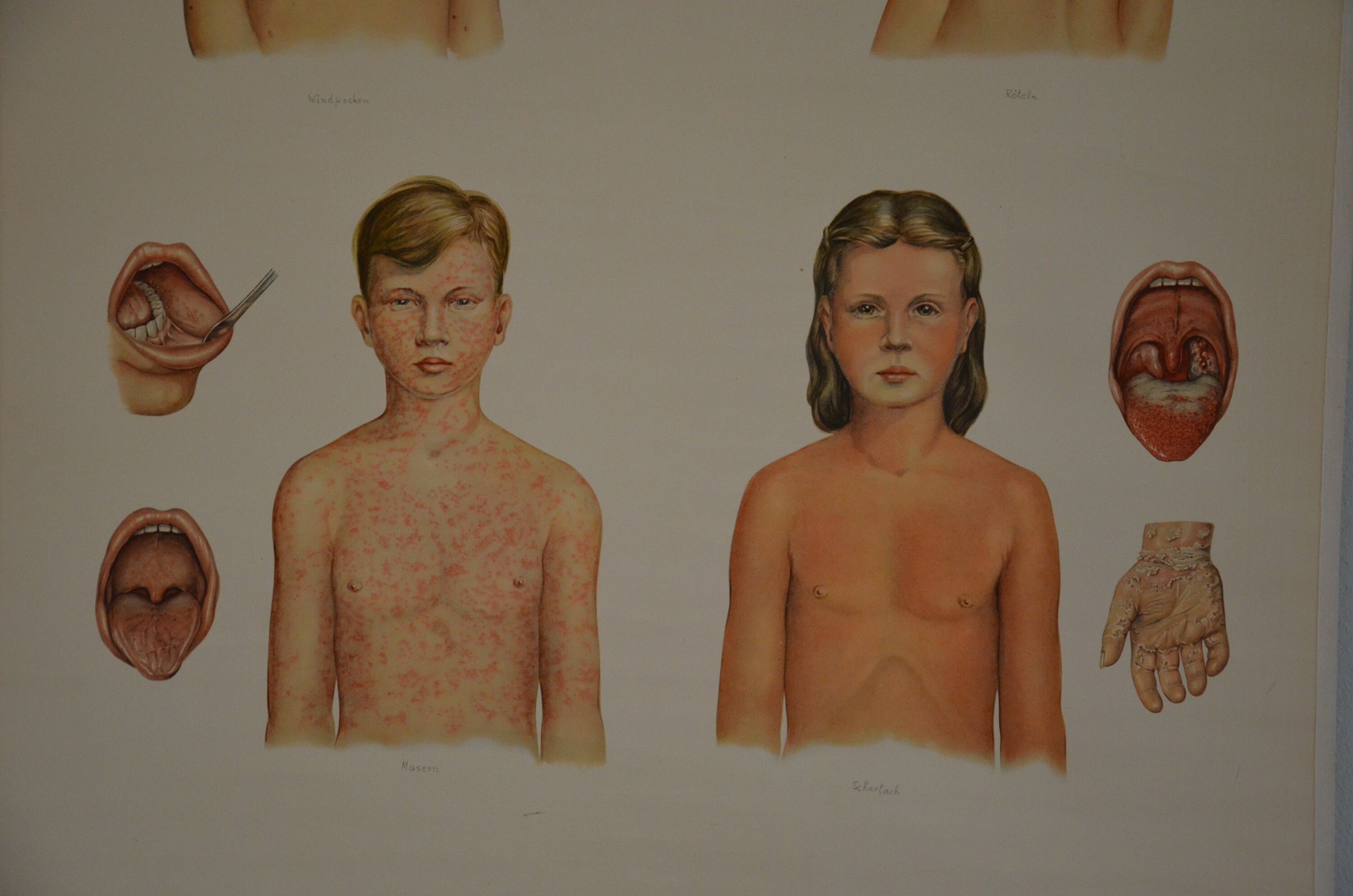 Infectious Diseases of Children Original Vintage 1950s German | Etsy