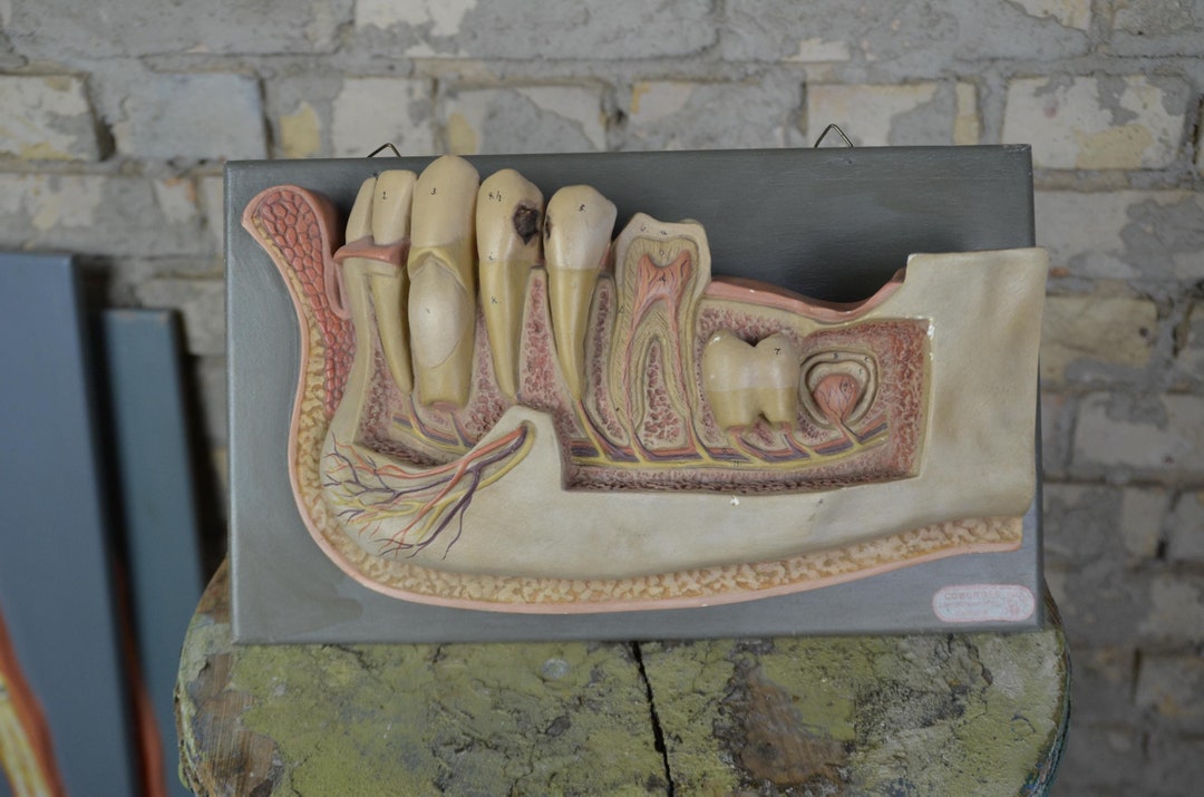 Human Teeth: Vintage Anatomical Model Original SOMSO Anatomy 1950s ...