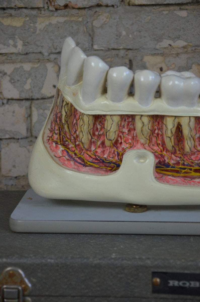 Giant Human Jaw Teeth: Vintage Anatomical Model Original - Etsy