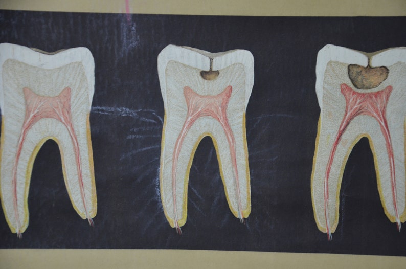 Human Teeth Anatomy, Dentition: Original Antique 1920s German ...