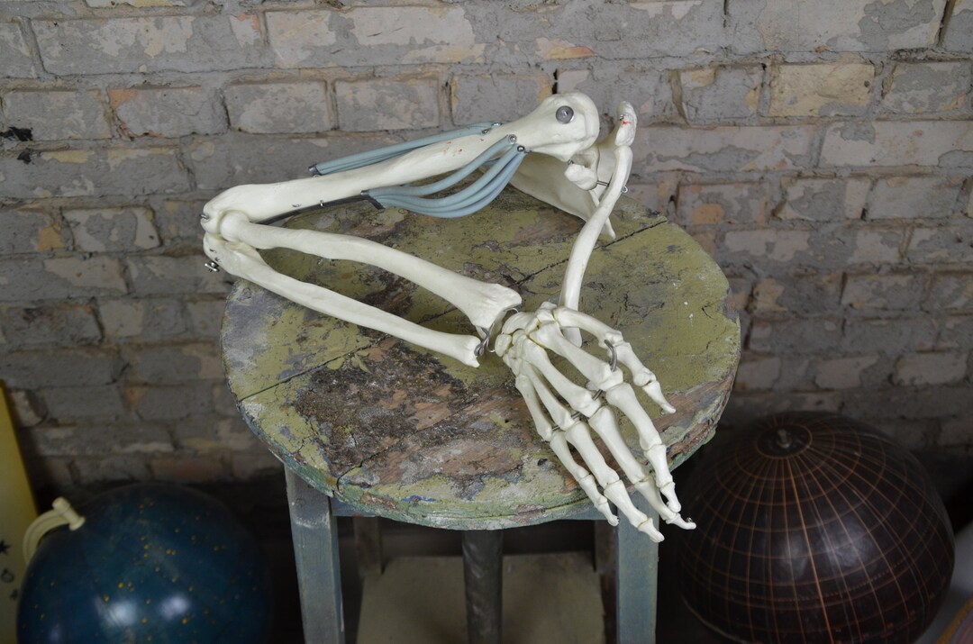 Human Arm, Shoulder & Hand Anatomy, Skeleton: Original SOMSO QS 55 ...