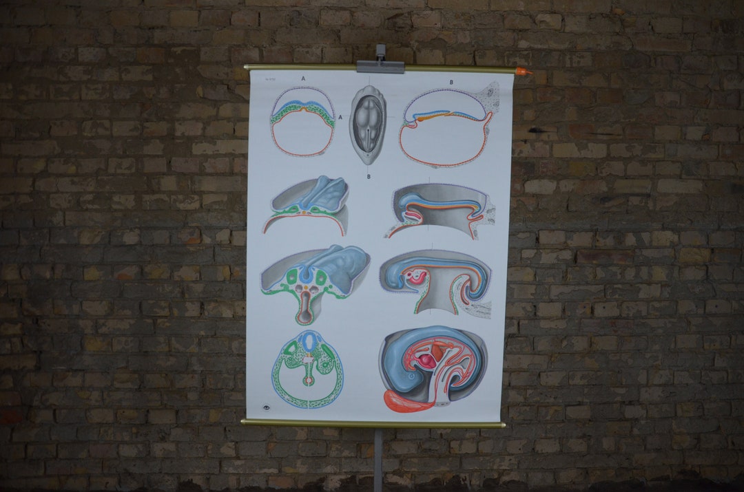 Embryo Anatomy, Development, Pregnancy: Original Vintage 1970s German ...