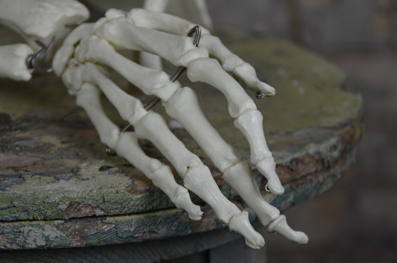 Human Arm, Shoulder & Hand Anatomy, Skeleton: Original SOMSO QS 55 ...