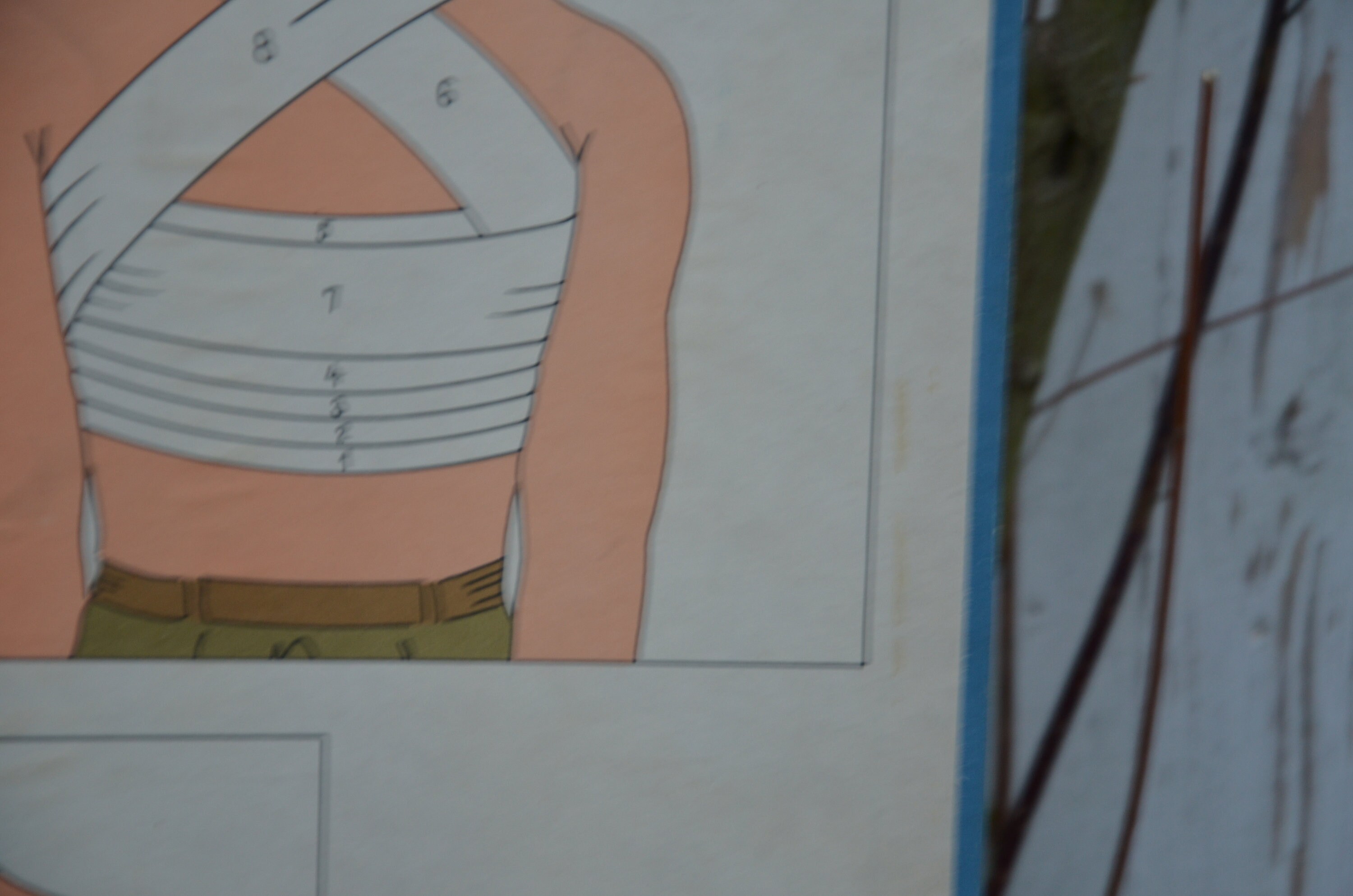 Chest Injury Bandages Dressings: Original Vintage 1950s Czech - Etsy UK