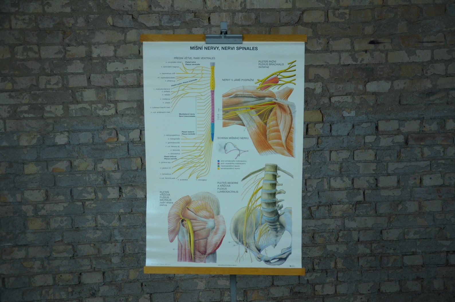 Spinal Nerves, Arm, Neurology: Original Vintage 1990s Czech Educational ...