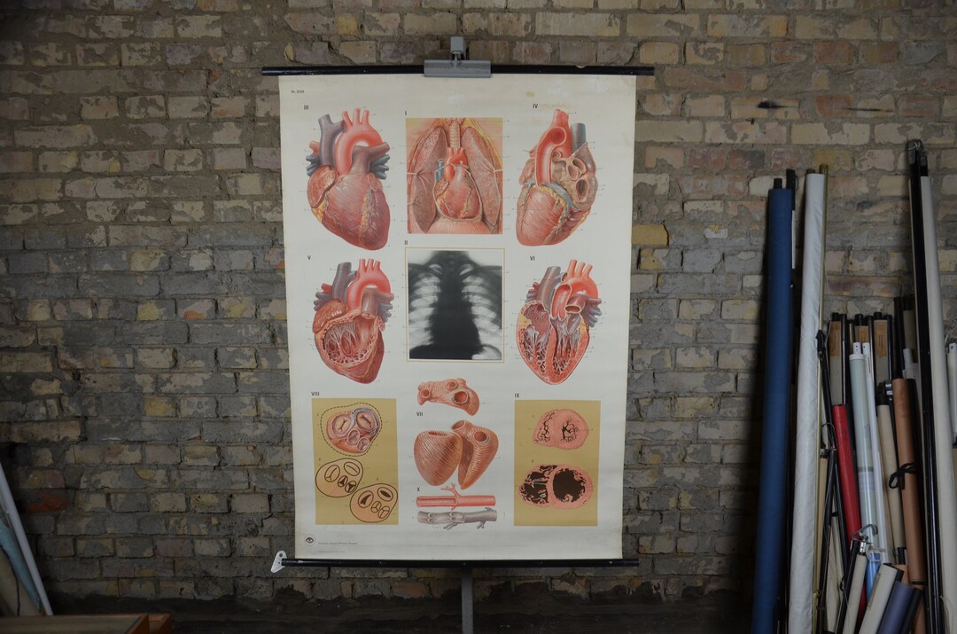 Human Heart, Anatomical Poster: Original Vintage 1950s German Medical ...