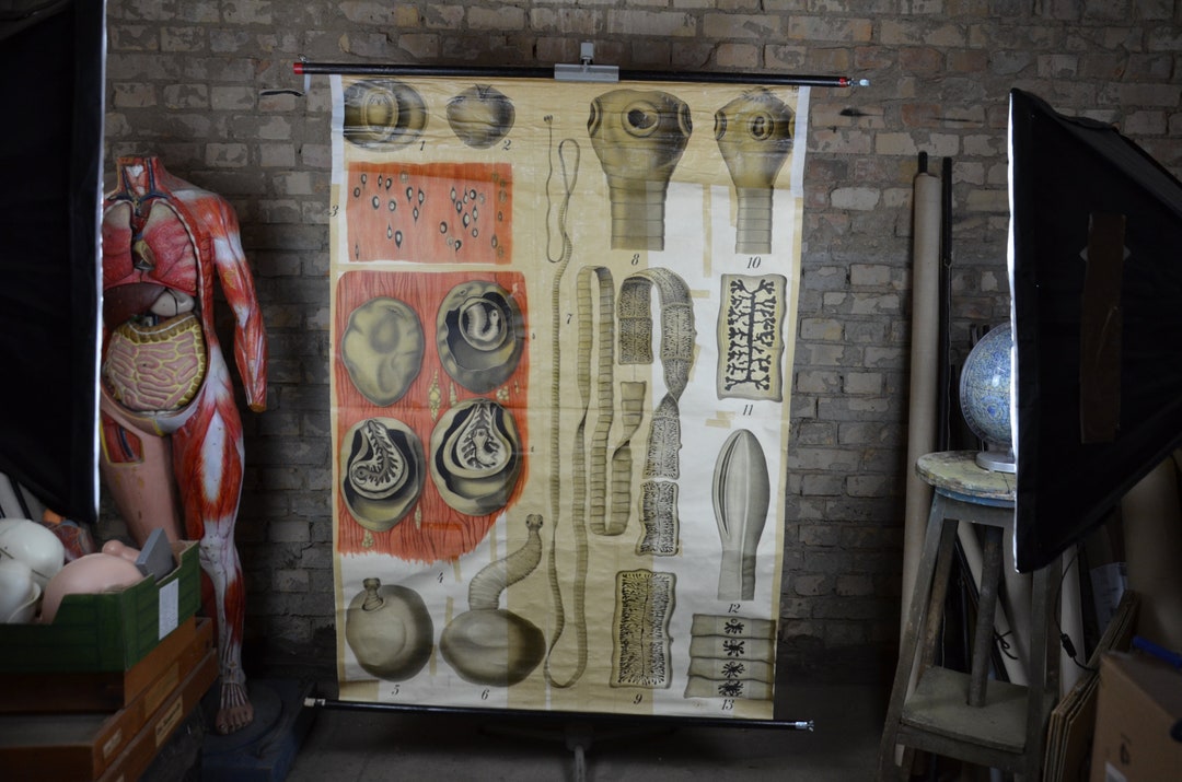 Tapeworm, Intestinal Parasite: HUGE Original Antique 1890s German ...