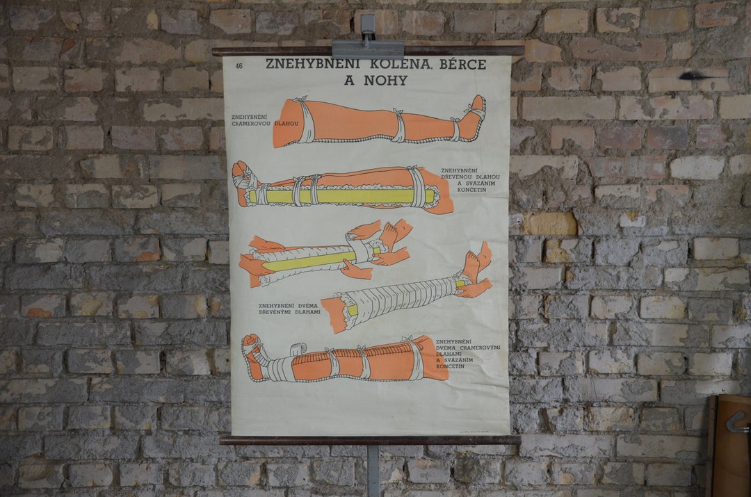 Leg Splint, Injury Bandages, Fracture: Original Vintage 1950s Czech ...