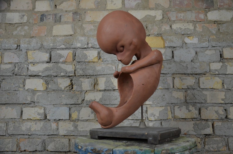 Human Foetus, Exceptional Antique Anatomy Model: Original 1880s German ...