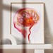 Abstract Cerebral Angiography Art Print-brain Art-neurology ...