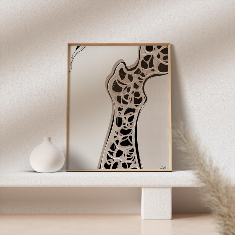Femur Art Print Hip Joint Art Poster-joint Replacement Art - Etsy