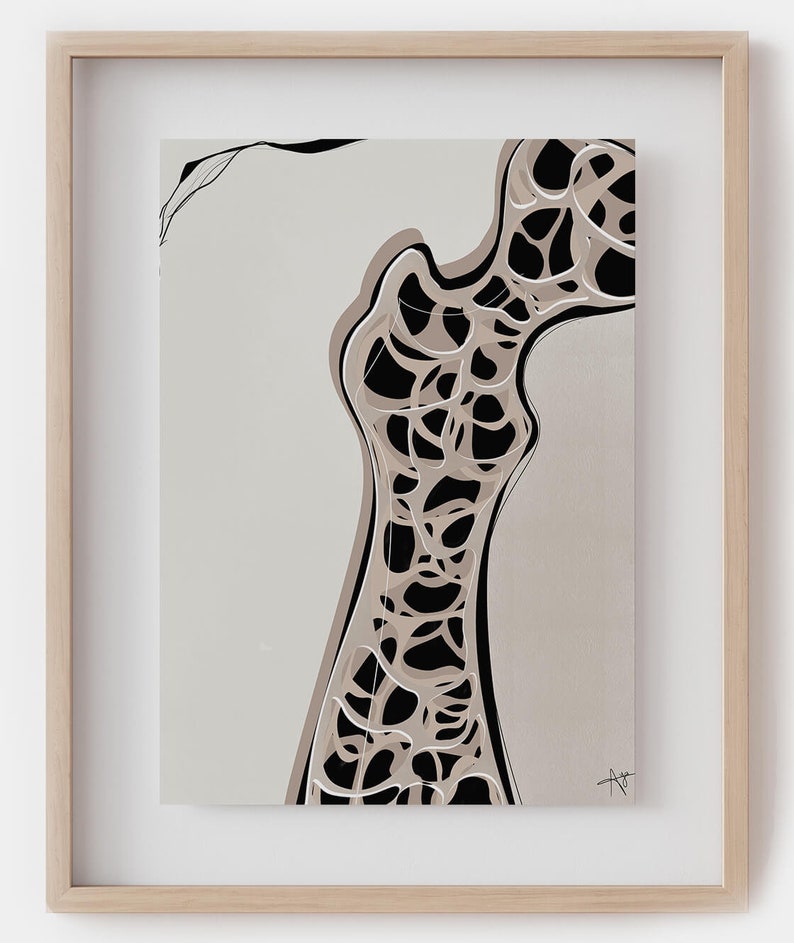Femur Art Print Hip Joint Art Poster-joint Replacement Art - Etsy