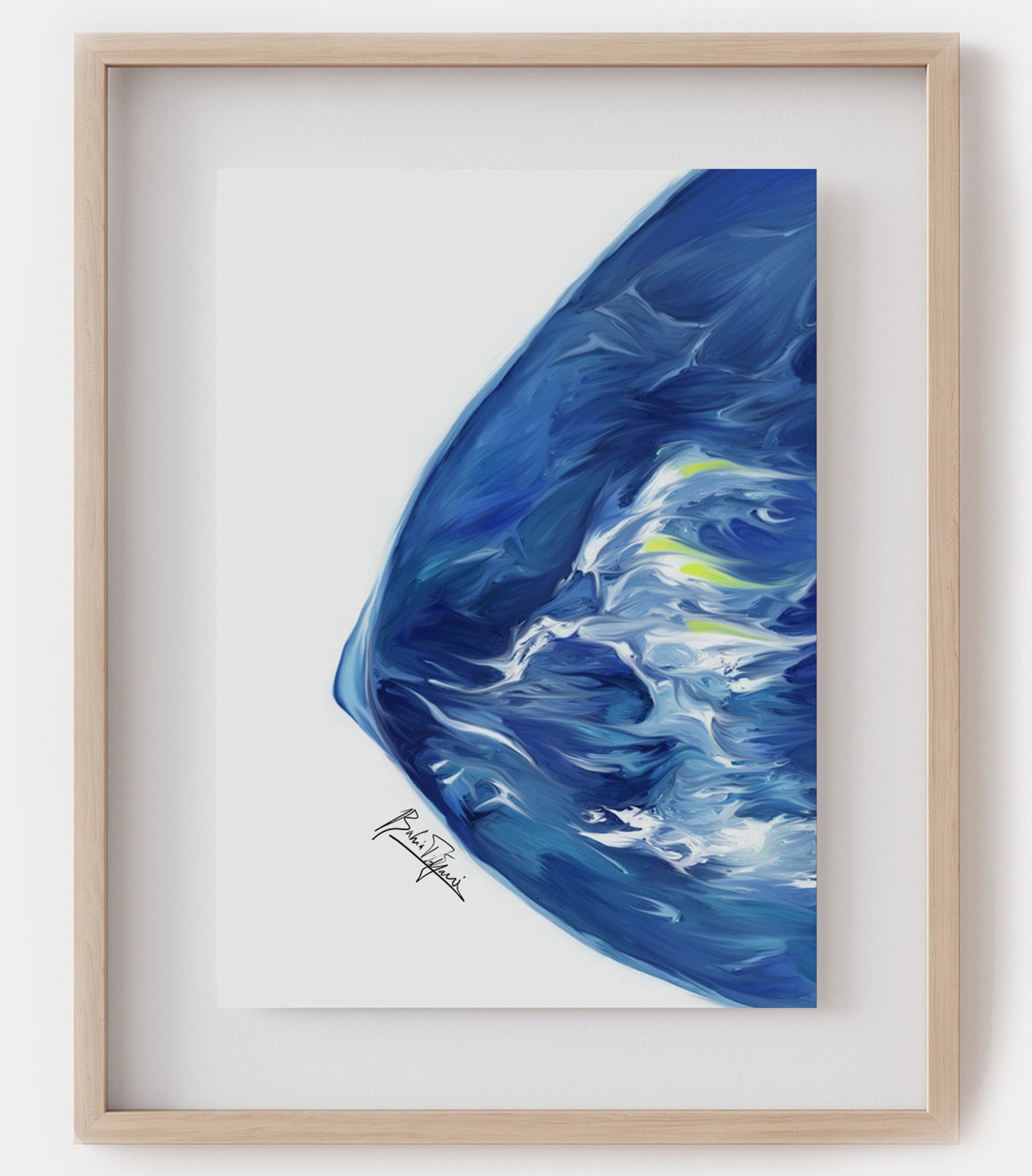 Abstract Mammogram Art Print Breast Anatomy Art Oncology - Etsy