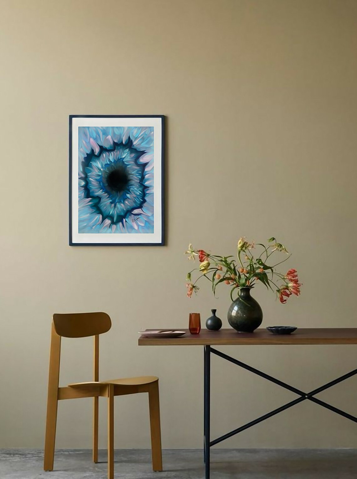 Constricted Iris Anatomy Art Print Optometrist - Etsy