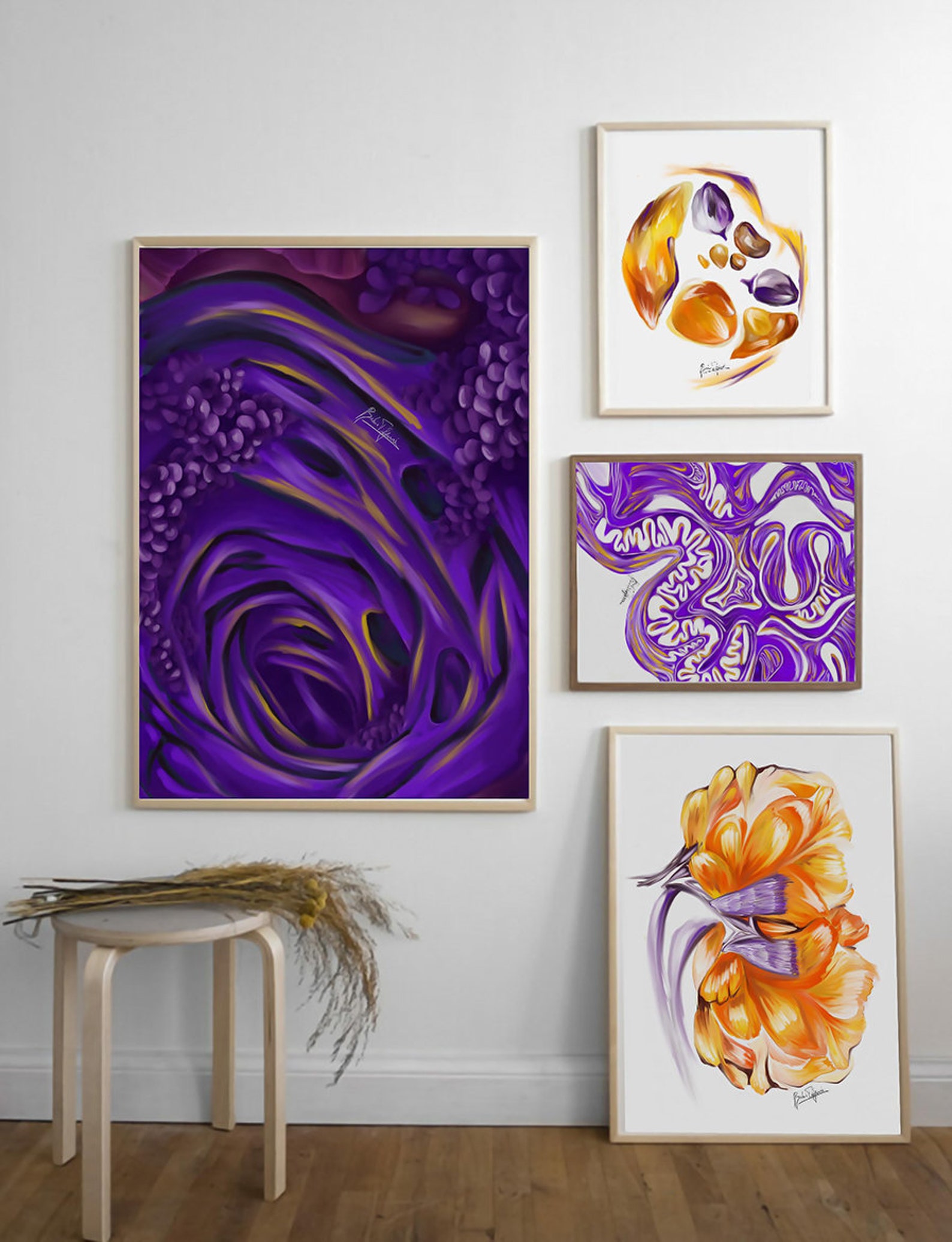 Colonoscopy Abstract Anatomy Art Print gastrointestinal Wall - Etsy