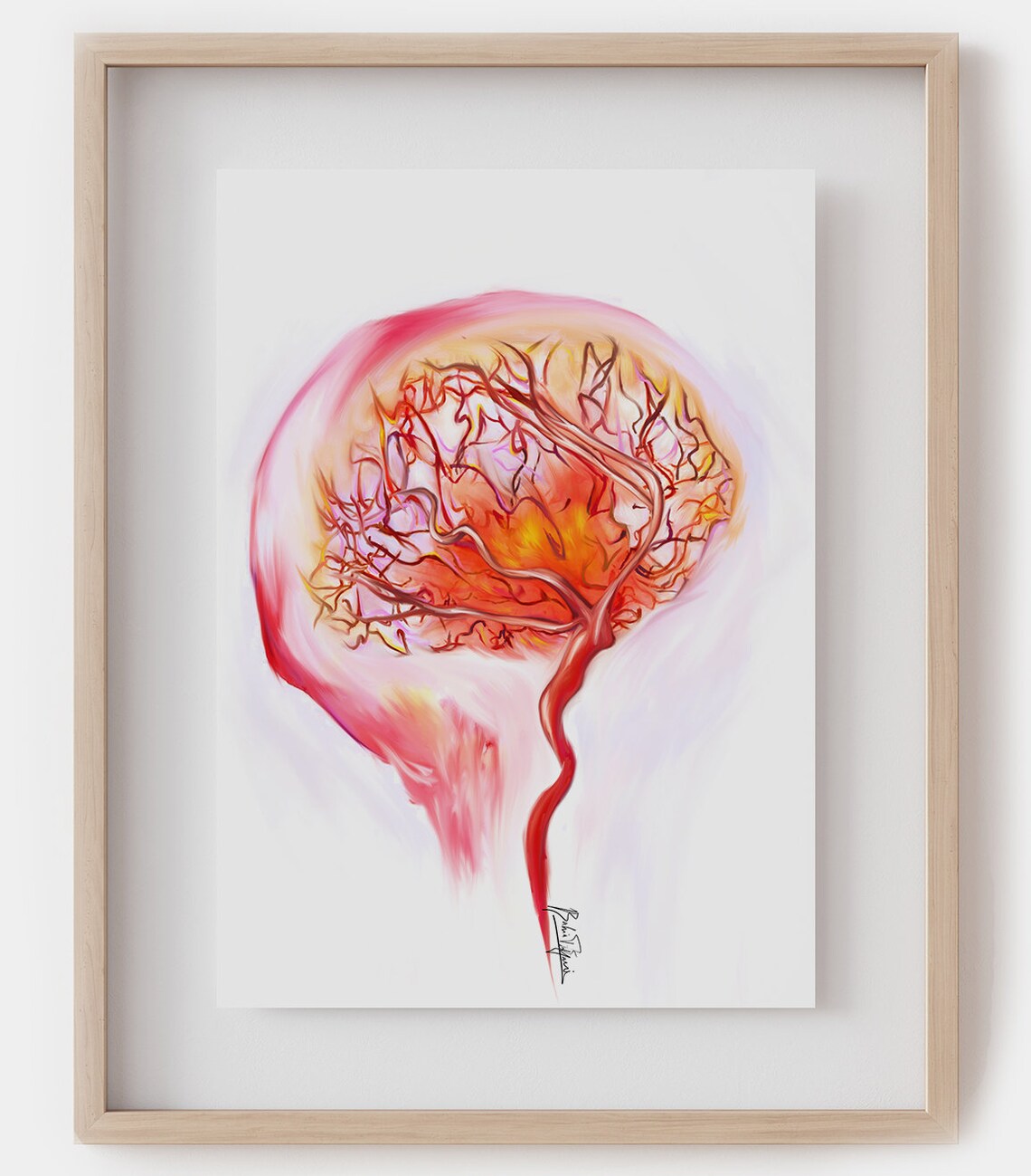 Abstract Cerebral Angiography Art Print-brain Art-neurology | Etsy