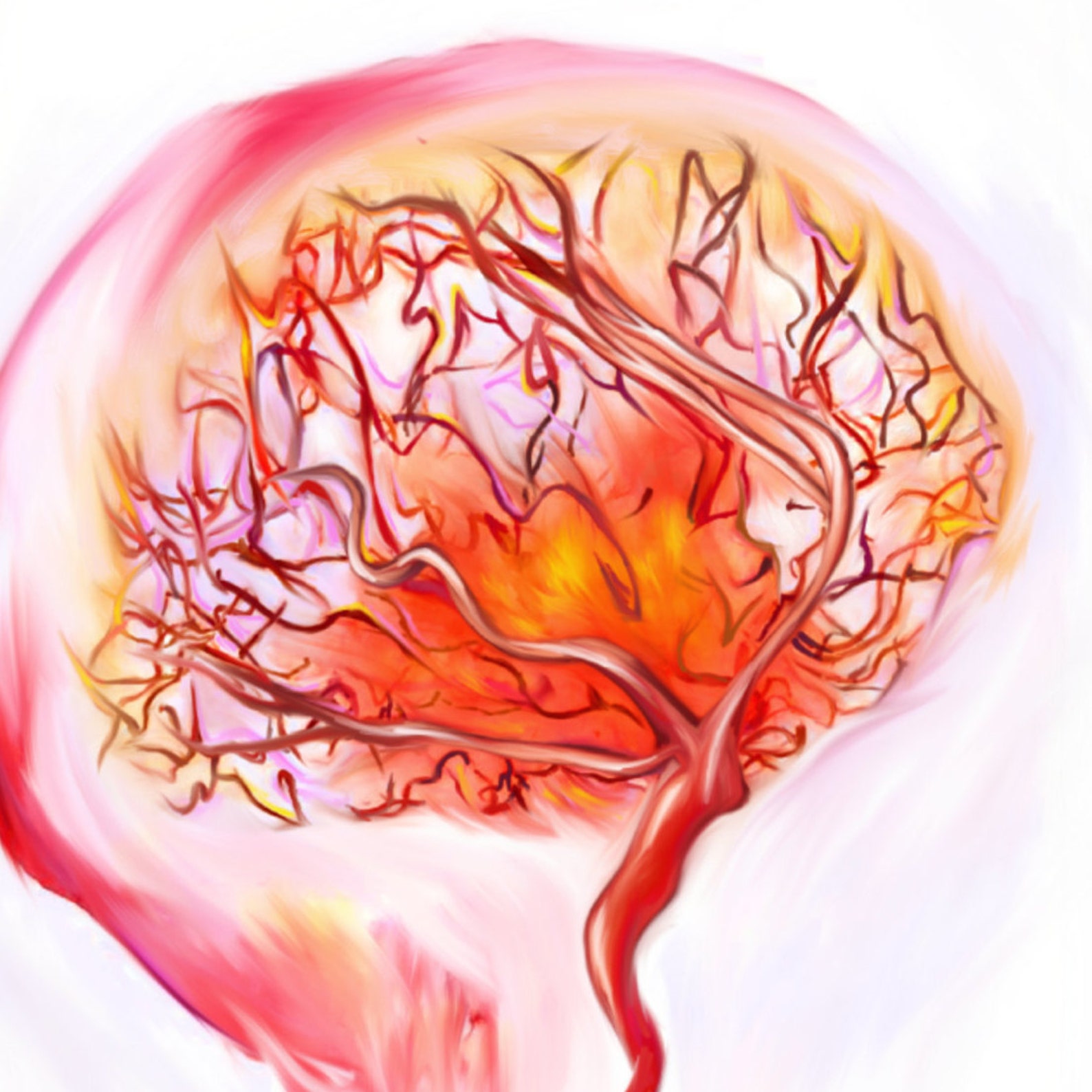 Abstract cerebral angiography art print-Brain Art-Neurology | Etsy